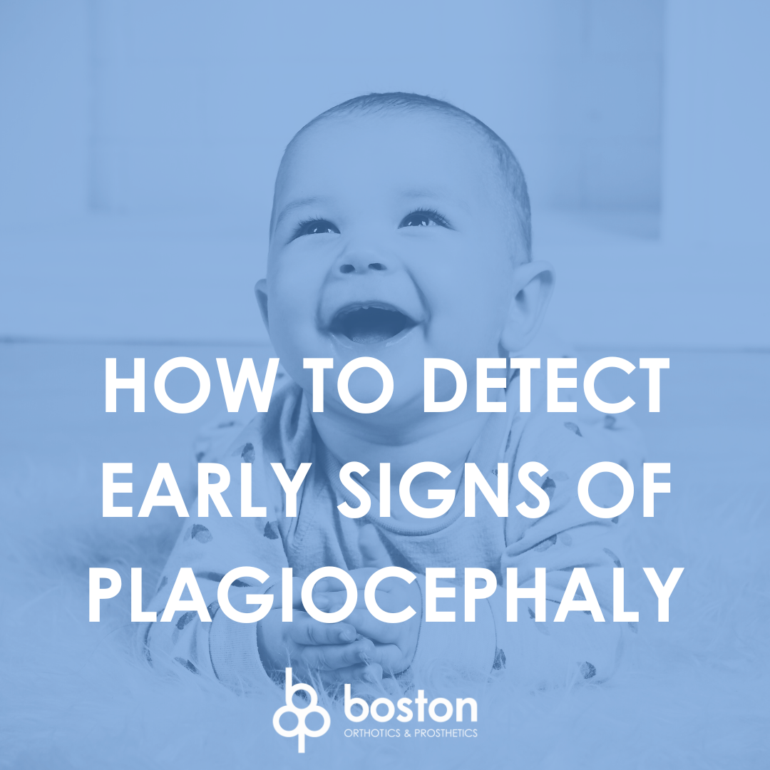 Plagiocephaly Information & Treatment Options for Parents